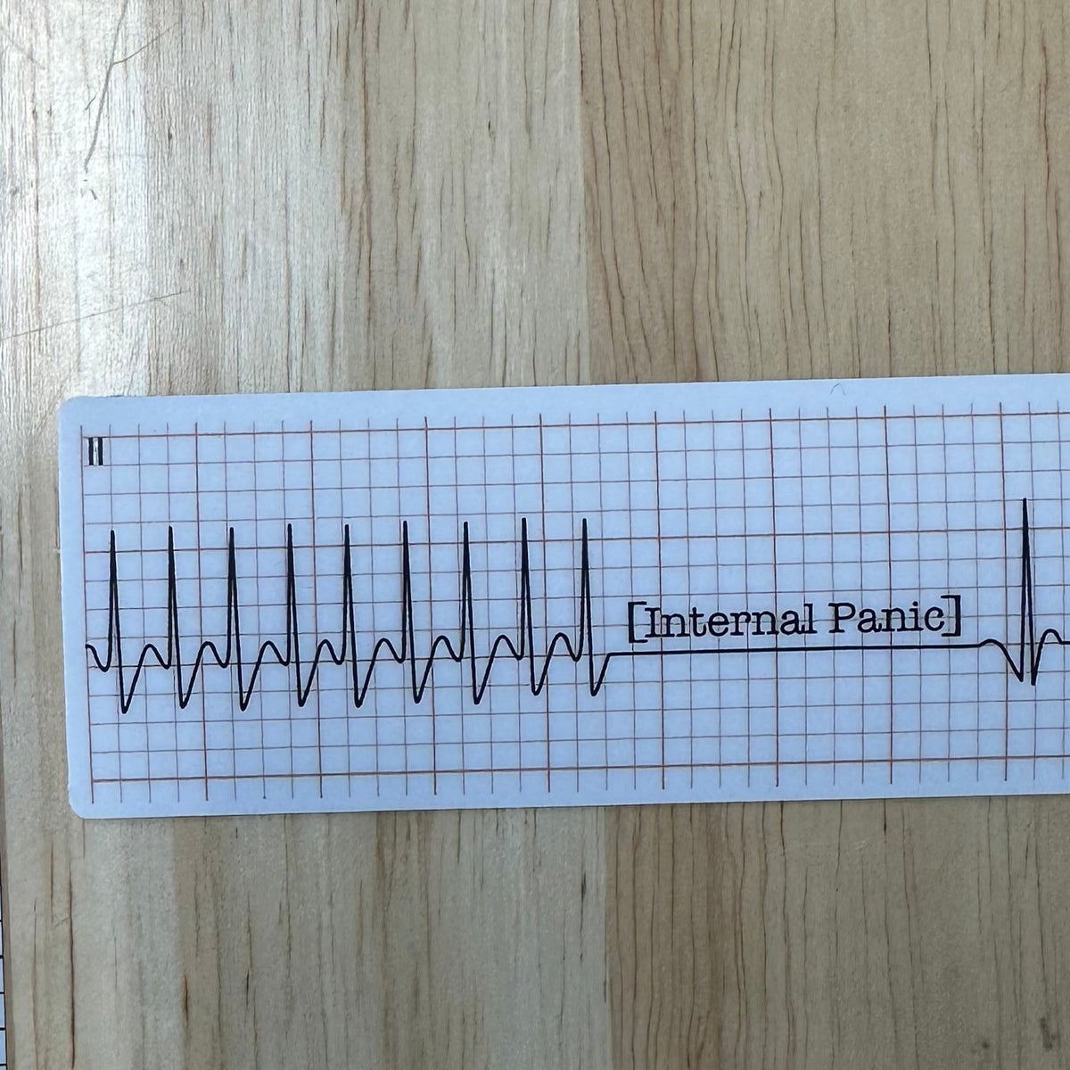 Internal Panic Cardioversion EKG Sticker – The Daily Medic